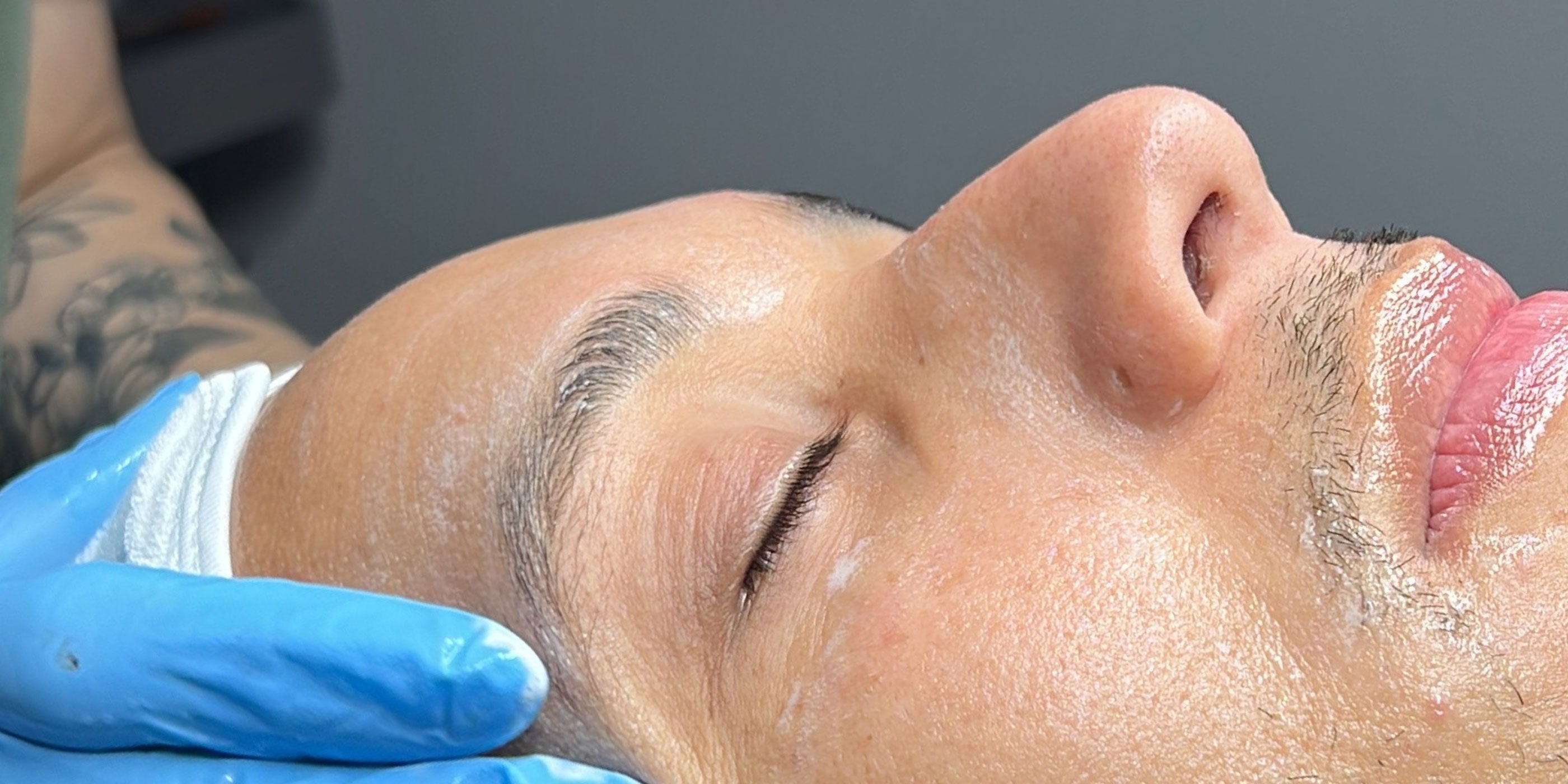Hydrafacials – Legendary Spa